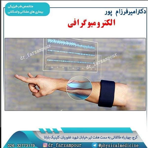 الکترومیوگرافی | تست ماهیچه عصبی | دکتر امیر فرزام پور